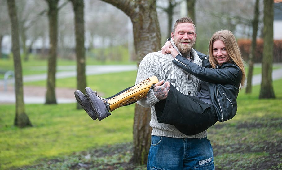 Maria blev født med kun ét ben: Viser stolt sit kunstige ben frem