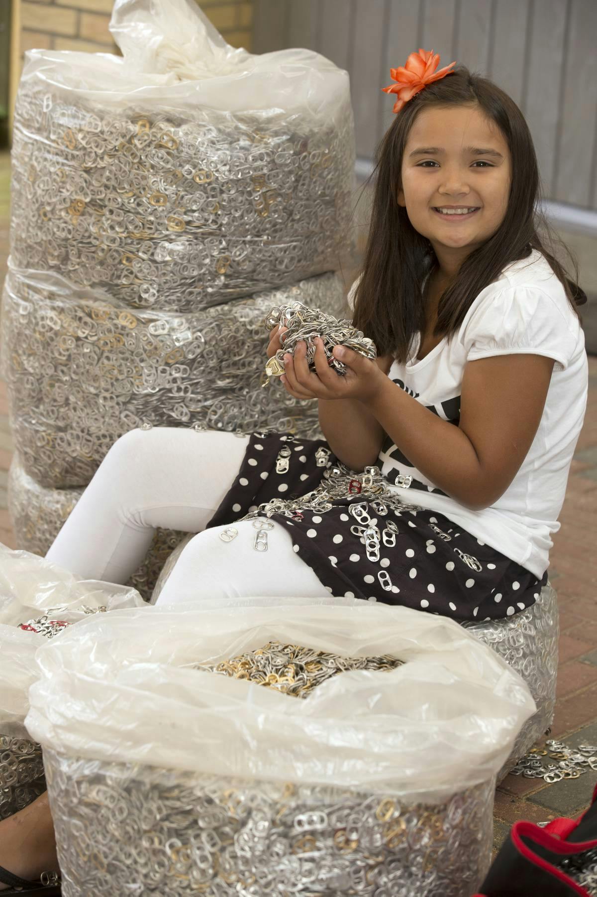 Proteser til ben gøres muligt af 10årige Vanessa